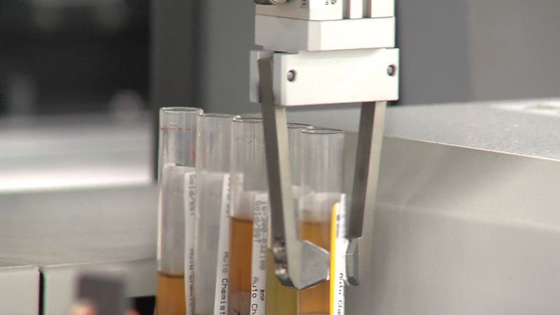 Revolutionary blood processing lab opens at UAB - Yellowhammer News